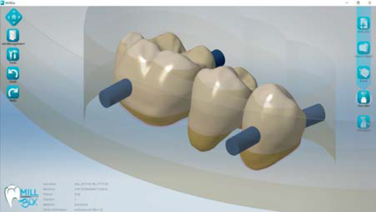 MillBox Dental CAM Software – ETI Empire Direct