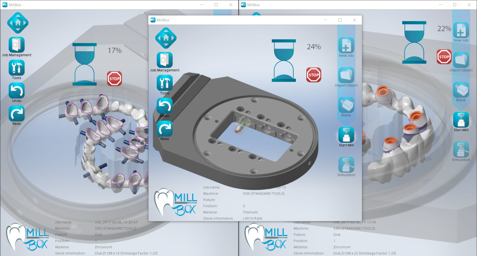 MillBox Dental CAM Software – ETI Empire Direct