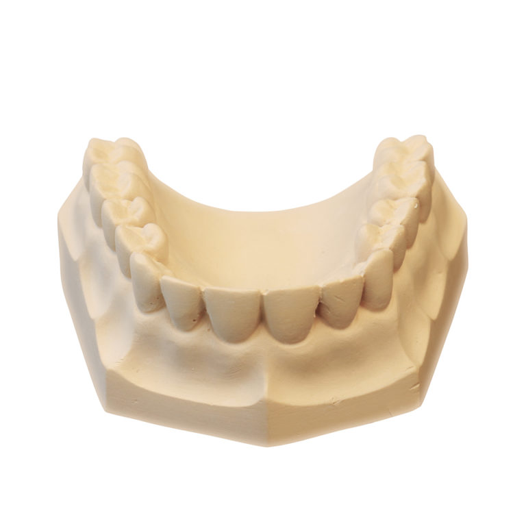 Gypsum & Die Stone – ETI Empire Direct