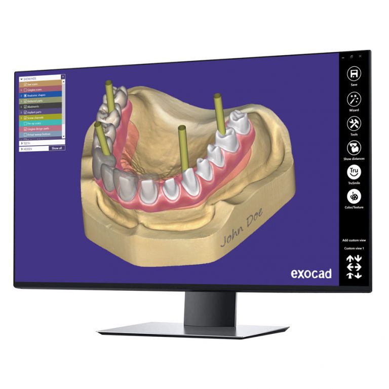 Dental Gypsum, Die Stone, CAD/CAM Dentistry | ETI Empire Direct